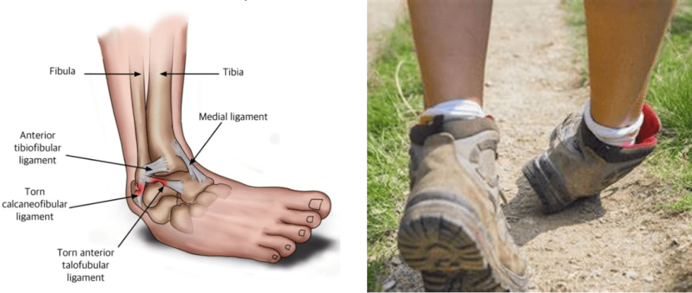 Podiatry > Gloucester Health & Care NHS Trust