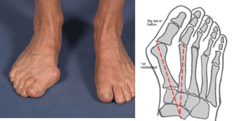 Podiatry > Gloucester Health & Care NHS Trust